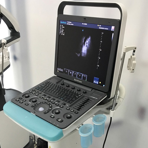 Sonoscape S8 Portable Ultrasound - LAKSAMANA KARYA