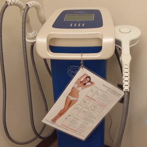 Pollogen Apollo Tripollar Laser - LAKSAMANA KARYA