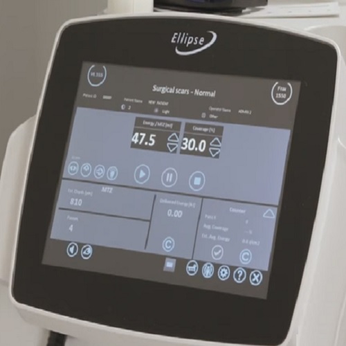 Candela Ellipse Nordlys IPL Laser System - LAKSAMANA KARYA